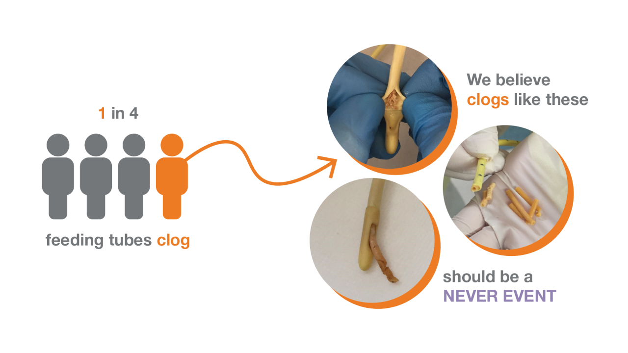 TubeClear - Feeding Tube Clearing System